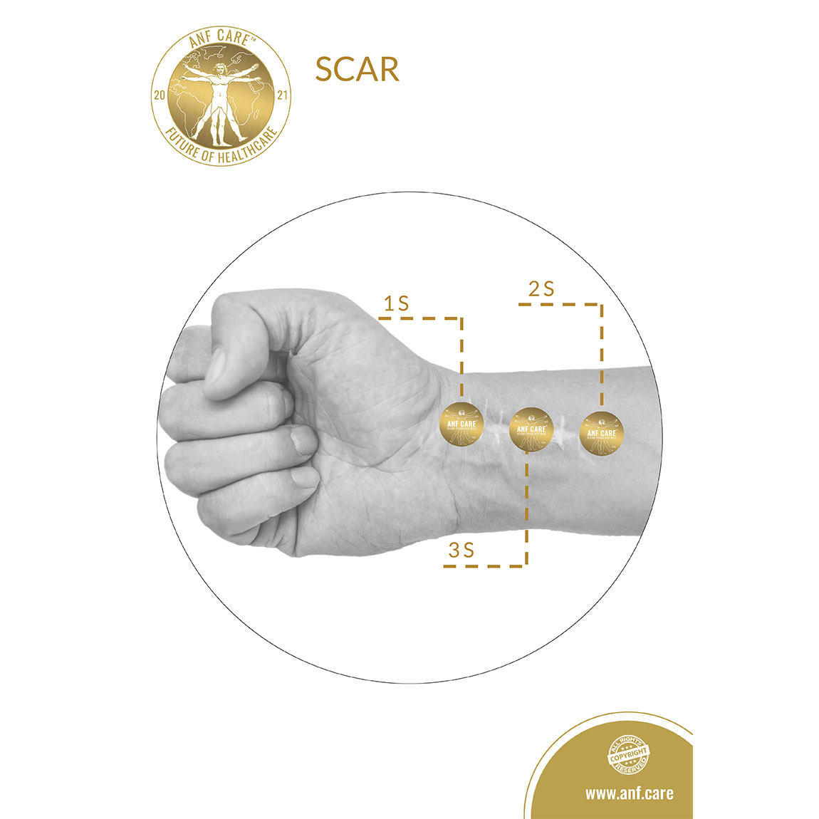 Scar - ANF Care